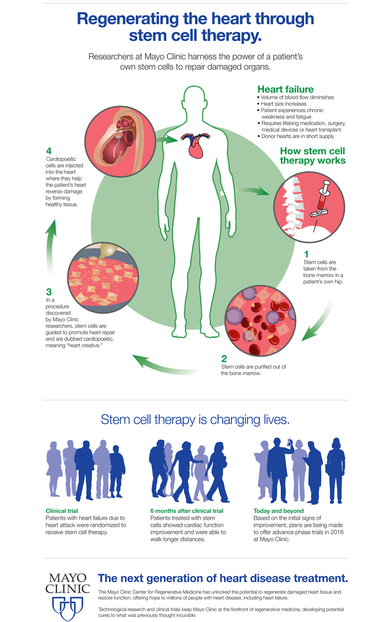 Regenerating heart through stem cell therapy
